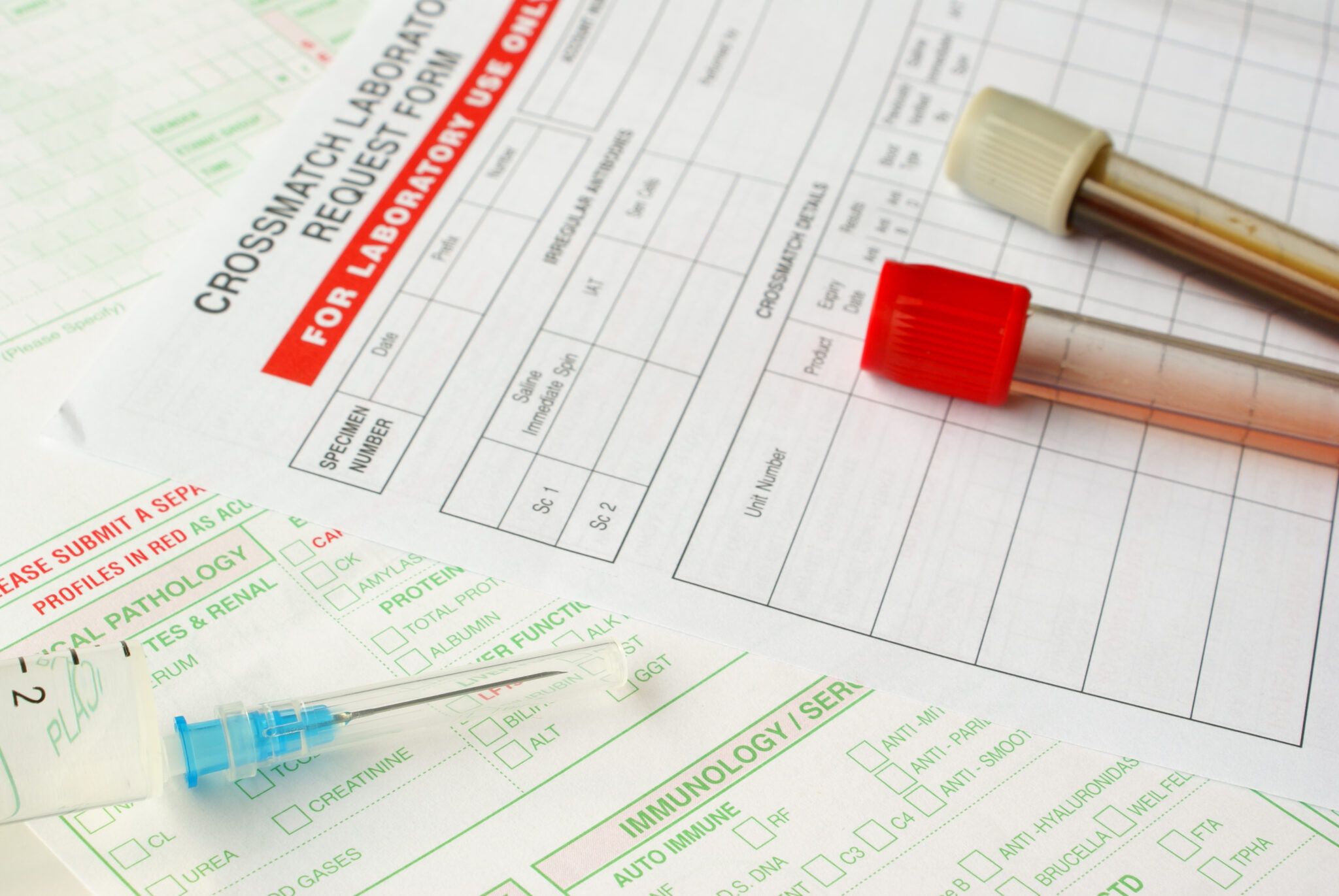 Lyme Disease Labs | Lyme Disease Testing in Labs